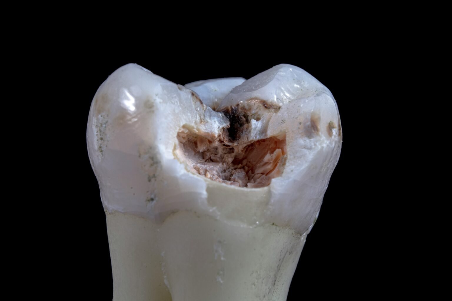 Everything You Need to Know About Permanent Tooth Implants - Invidiata ...