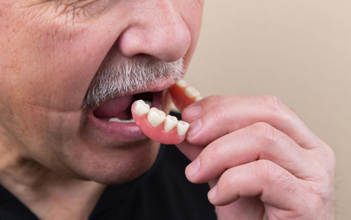 Understanding the Top 4 Common Causes of Jaw Misalignment in Children ...